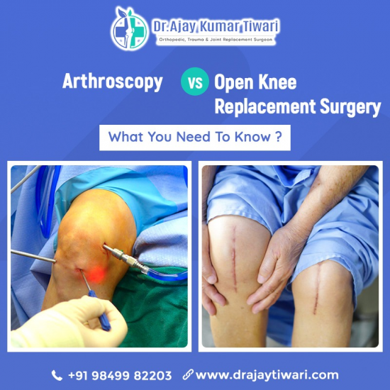 Arthroscopy vs open knee replacement surgery | Dr Ajay Tiwari