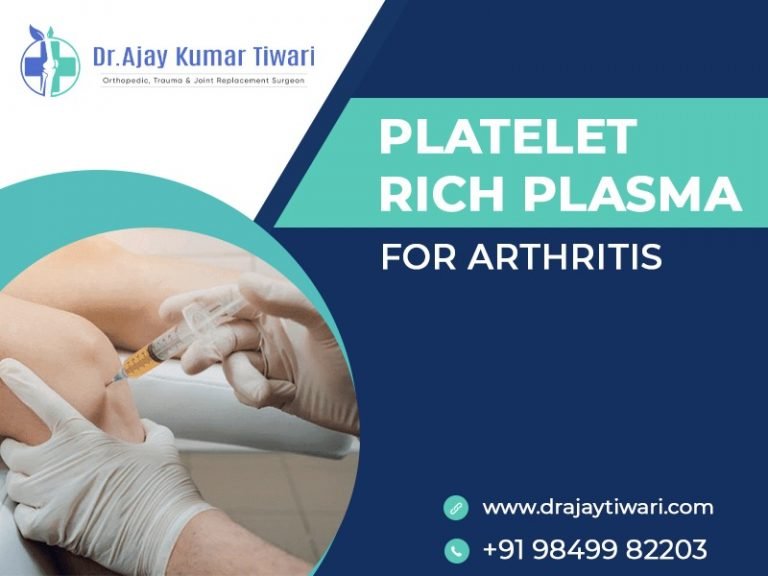 Platelet-rich plasma for arthritis | Dr Ajay Tiwari